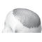 Cranial implant - BioMesh® - Bioplate