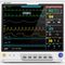 Portable patient monitor - MN-150 - EPSIMED - compact / ECG / RESP