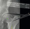 Orthopedic software - mediCAD Hectec GmbH - planning / preoperative ...