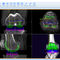 Orthopedic software - mediCAD Hectec GmbH - planning / knee / 3D