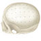 Custom-made cranial implant - PEEK-OPTIMA® - Kontour Medical Technology