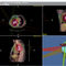 Radiation therapy software - DICOM RT Studio - PTW Freiburg ...
