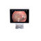 Dermatology camera - VersaScope - AMD Global Telemedicine - for ...