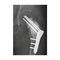 Femoral head compression plate - 00-0903-3840 - OrthoPediatrics - pediatric