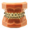Metal orthodontic bracket - Synergy FX® - Rocky Mountain Orthodontics ...