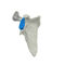 Reverse glenoid cavity prosthesis - Glenius - Materialise UK - revision ...