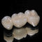 PFM dental bridge - ECONOMY - Derby Dental - posterior teeth