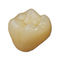 PMMA dental crown - CAD Temp - Derby Dental - anterior teeth ...