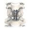 Cervical vertebral corpectomy prosthesis - VERTELIFT-C - NORMMED ...