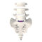 Thoraco-lumbar interbody fusion cage - Esa - NORMMED Medical Devices ...