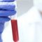 Blood collection tube - CELLSAVE® - Menarini Silicon Biosystems ...