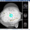 TMS neuronavigation system - 3D - Shenzhen Yingchi Technology
