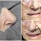 Nasal cosmetic prosthesis - lifelike - Medical Art Prosthetics - adult