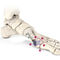 Hallux valgus osteotomy plate - Centrolock® - novastep - lateral ...