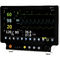 Tabletop patient monitor - CETUS x15 - aXcent medical - ECG / RESP / TEMP