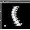 Medical software - ZedView - LEXI Co. - CT / spine surgery / viewer
