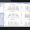 Electrophysiology software - NeuroMap - Delsys - analysis / acquisition / recording