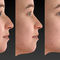 Skin topography system - VECTRA® H2 - CANFIELD - 3D skin imaging