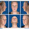 Skin imaging system - VECTRA® M3 - CANFIELD