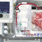 Transplantation organ perfusion system - OCS™ - TransMedics - heart ...
