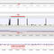 Analysis software - NₓClinical - Bionano Genomics - interpretation / NGS / medical