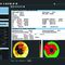 Medical software - SPHERE® 3.0 - Olea Medical - cardiology ...