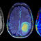 Medical software - APT CEST MRI V.1.0 - Olea Medical - for MRI ...
