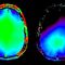Medical software - APT CEST MRI V.1.0 - Olea Medical - for MRI ...