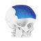 Custom-made cranial implant - Osteophoenix