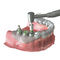 Dental surgery surgical navigation system - Neo NaviGuide - Neobiotech ...