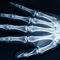 AI-assisted software - BoneView - Gleamer - medical / clinical / emergency
