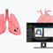 Lung cancer screening software - aviewLCS series - Coreline - medical ...