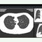 Lung cancer screening software - LCS - Coreline - medical / CT / image ...