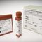 Anti-CCP2 test kit - FHCCP100 - Axis-Shield PLC - for rheumatoid ...