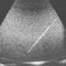 Ultrasound catheter - WALLACE® SURE-PRO® ULTRA - CooperSurgical ...
