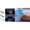 On-platform ultrasound system - MyLab™X90 - Esaote - for multipurpose ...