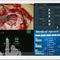 Operating room video recorder - MVR - MediCapture - USB / 4K / HD
