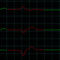 3-channel Holter monitor - Chroma2™ - ScottCare