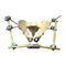 Pelvis external fixation system - Hoffmann 3 - Stryker - tibia / femur ...