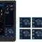 On-platform ultrasound system - Aplio i700 - Canon Medical Systems ...