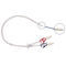 Hemodialysis catheter - Arrow-Clark™ VectorFlow® - Truphatek ...