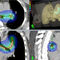 Medical software - VariSeed™ - Varian Oncology - for brachytherapy ...