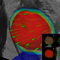 Medical software - VariSeed™ - Varian Oncology - for brachytherapy ...