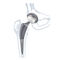 Femoral head prosthesis - Isocer® - Aesculap®