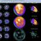 Nuclear medicine android application - Xeleris V - GE Healthcare - CT ...
