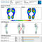 Electrophysiology software - myoPRESSURE™ - NORAXON - analysis