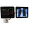 Modular multi-parameter monitor - XPREZZON™ - Spacelabs Healthcare ...