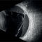On-platform, tabletop ultrasound system - ABSolu - Quantel Medical ...