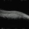 On-platform, tabletop ultrasound system - ABSolu - Quantel Medical ...