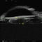 On-platform, tabletop ultrasound system - ABSolu - Quantel Medical ...